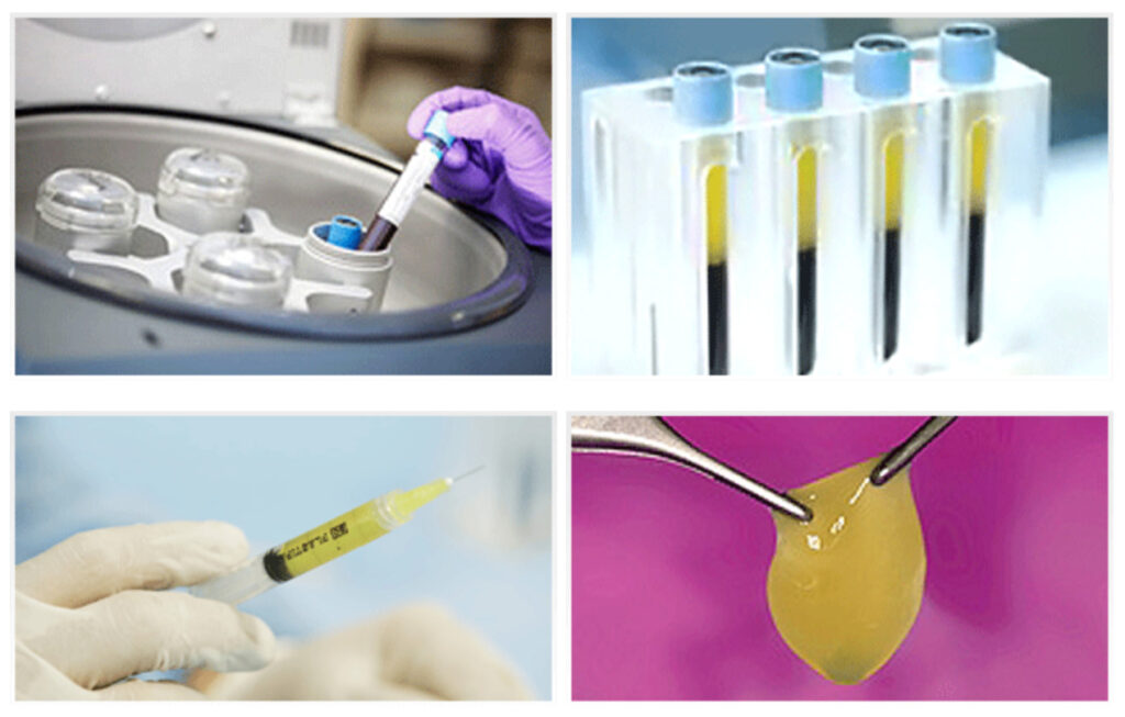 再生歯科医療 – 高根デンタルクリニック